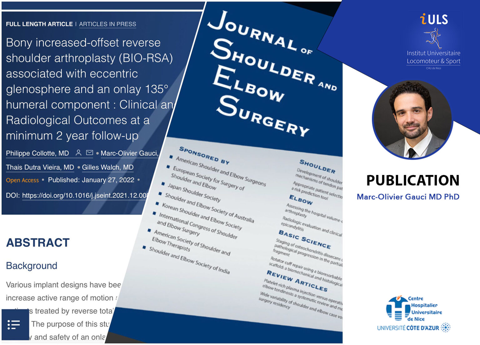 Publication "BIO-RSA associated with eccentric glenosphere and an onlay ...